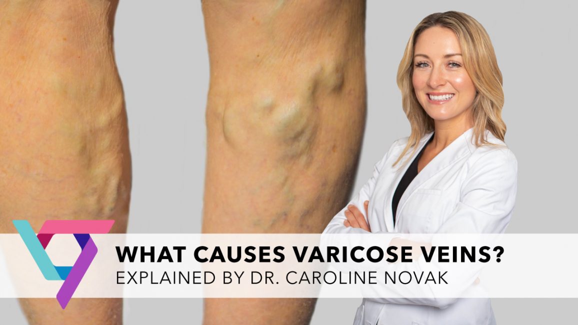 Harvard Trained Vein Doctor | Cutting Edge Treatments for Varicose ...