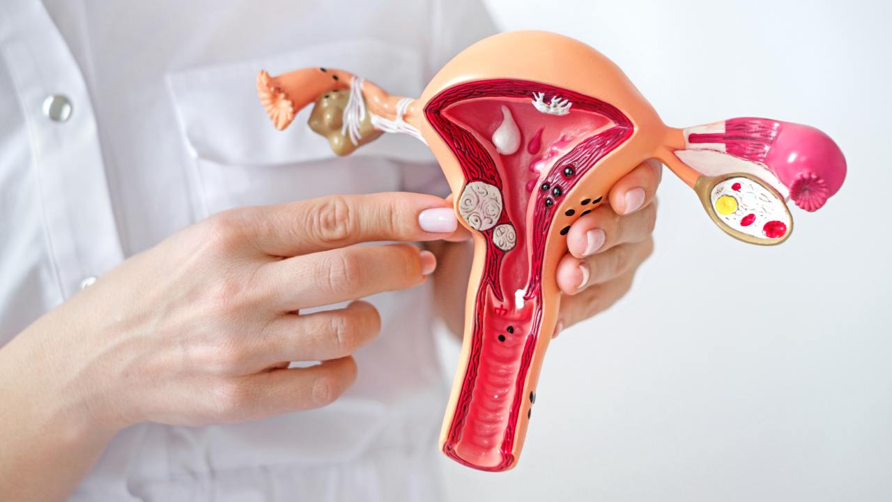 Uterine Fibroid Treatment | UFE Procedure by Expert Doctors